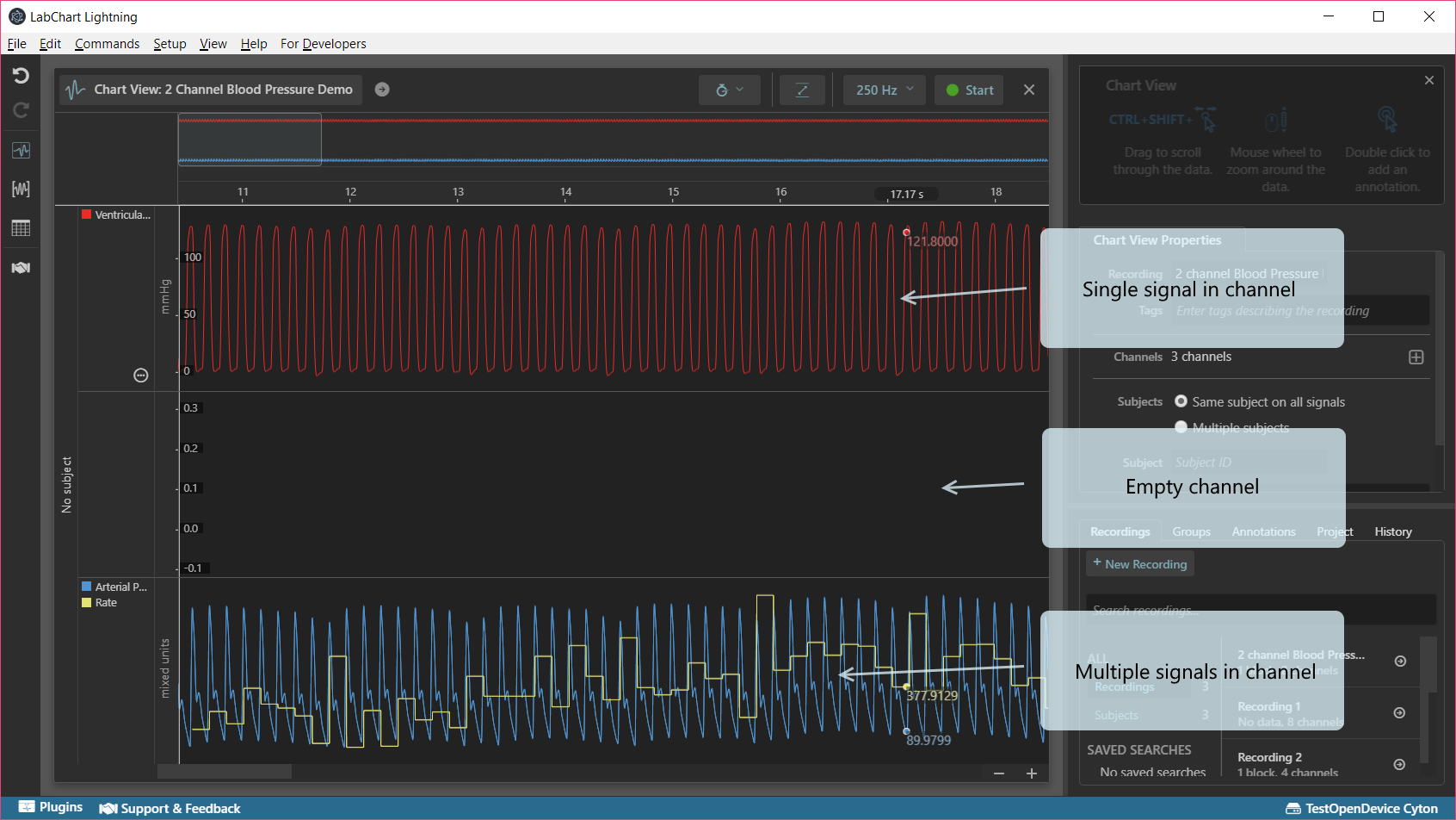 How are Signals and Channels configured in LabChart Lightning ...