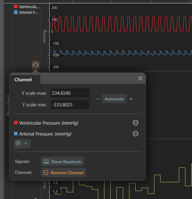 How are Signals and Channels configured in LabChart Lightning ...