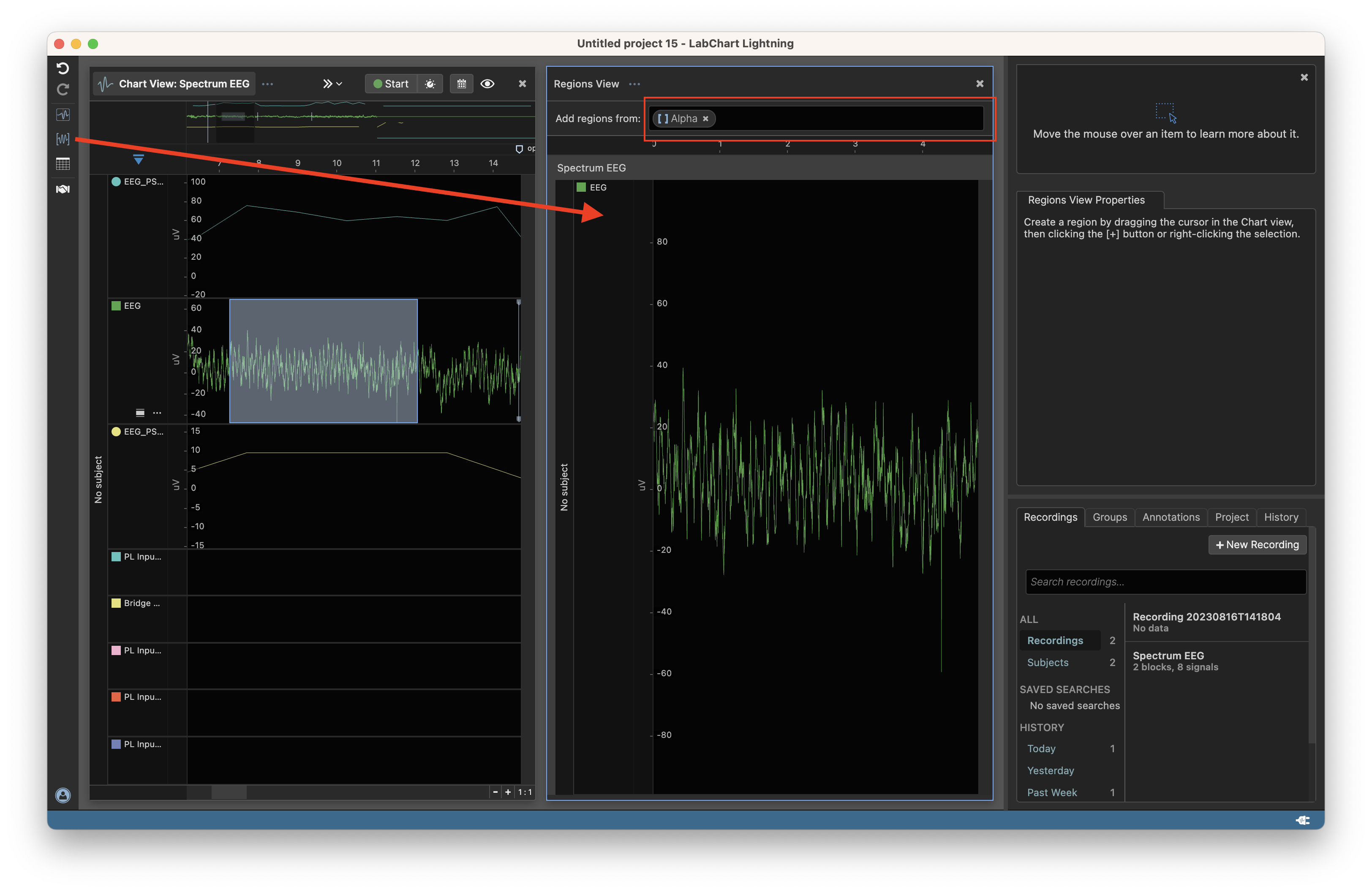 How do I use Regions View in LabChart Lightning? | ADInstruments