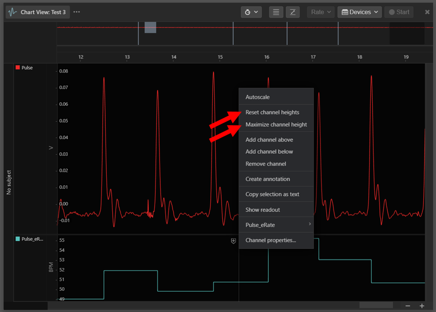How do I adjust channel heights in LabChart Lightning? | ADInstruments
