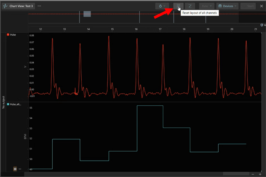 How do I adjust channel heights in LabChart Lightning? | ADInstruments